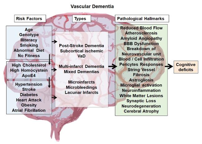 Multi Infarct Dementia Life Expectancy