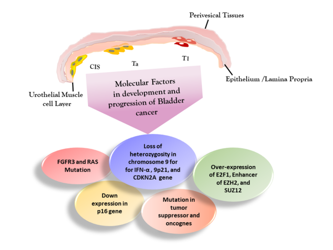 Bladder Cancer Grading