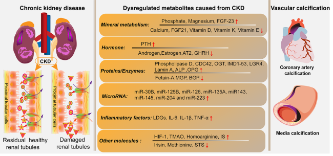 Vascular Calcification In Chronic Kidney Disease Not All Extraosseous