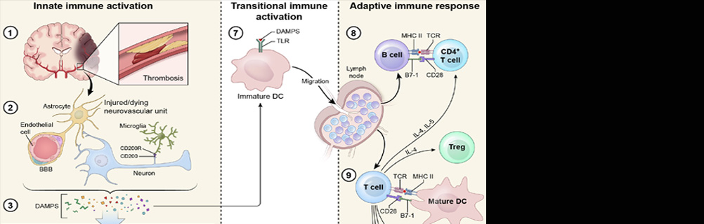 Catecholamines, Steroids and Immune Alterations in Ischemic Stroke and ...