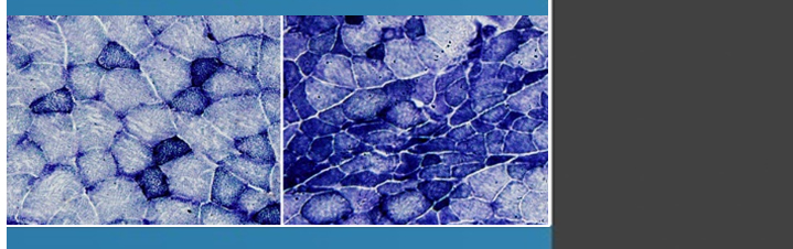 Five-Minute Cognitive Test as A New Quick Screening of Cognitive ...